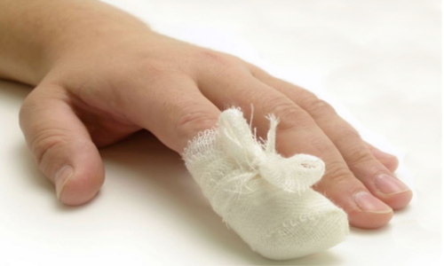 finger-bandaged 500x300 - Tawsa LTD